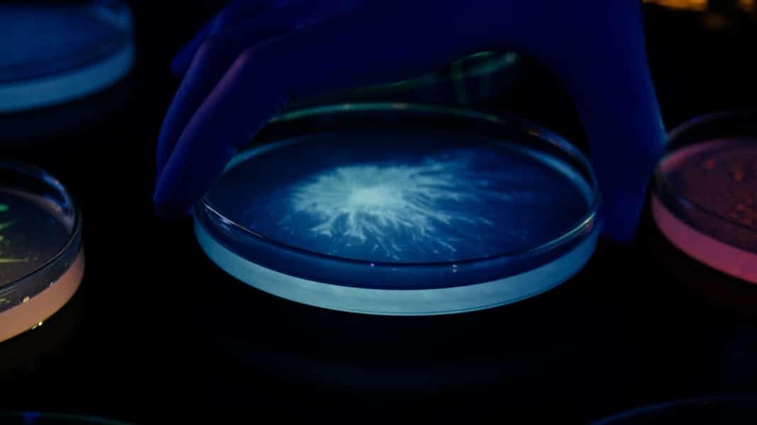 L'Oréal acquires skin microbiome specialist Lactobio - Luxus Plus